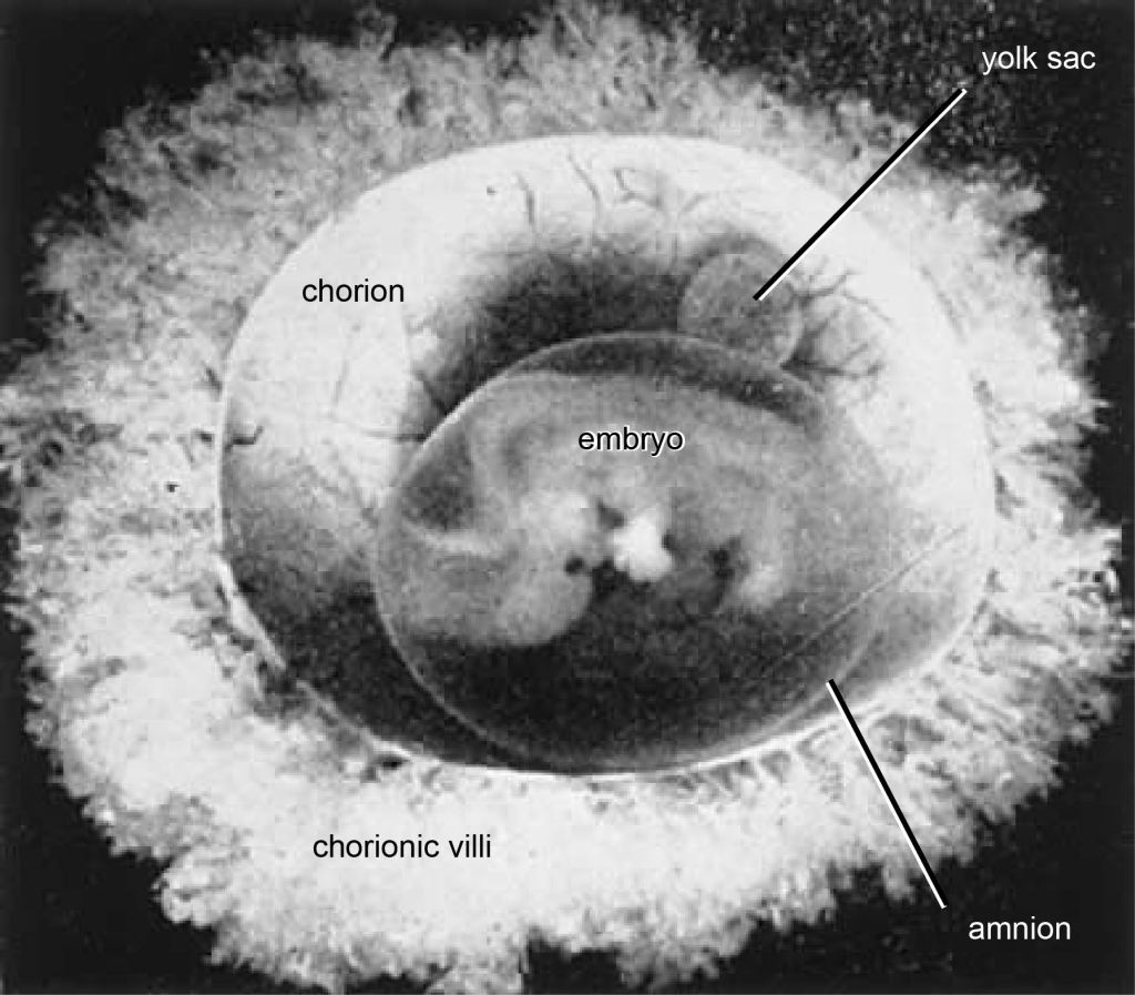 What are twins, anyway? – My Momo Journey